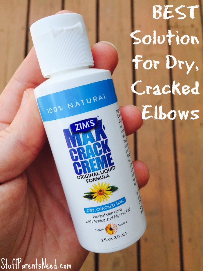 Dry Cracked Elbows: What Works to Eliminate Them - Stuff Parents Need
