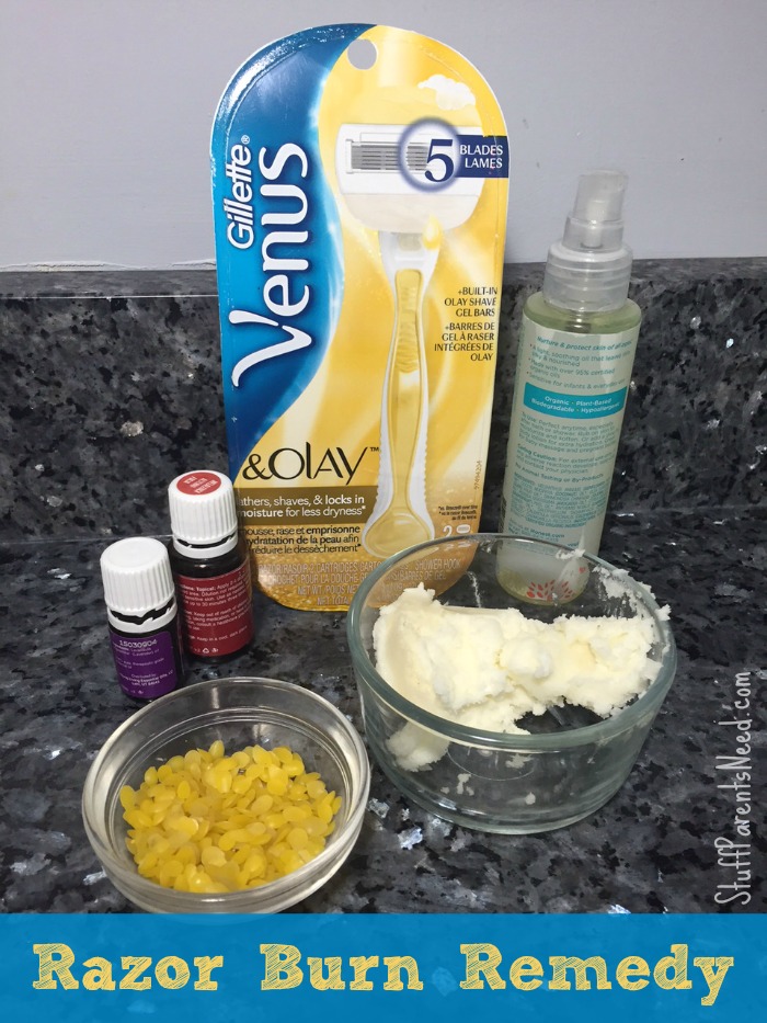 Razor Burn on Legs? How to Take Care of It and Move On with Your Busy ...